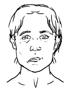 Mayo Clinic Q and A: 5 things to know about stroke - Headline Health