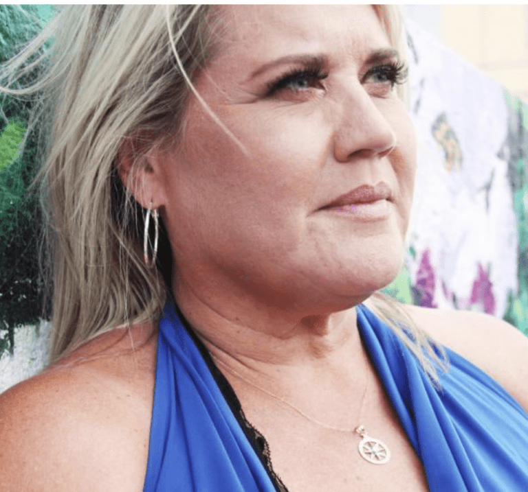 Osteoporosis screening guidelines updated: Do you need a bone scan ...